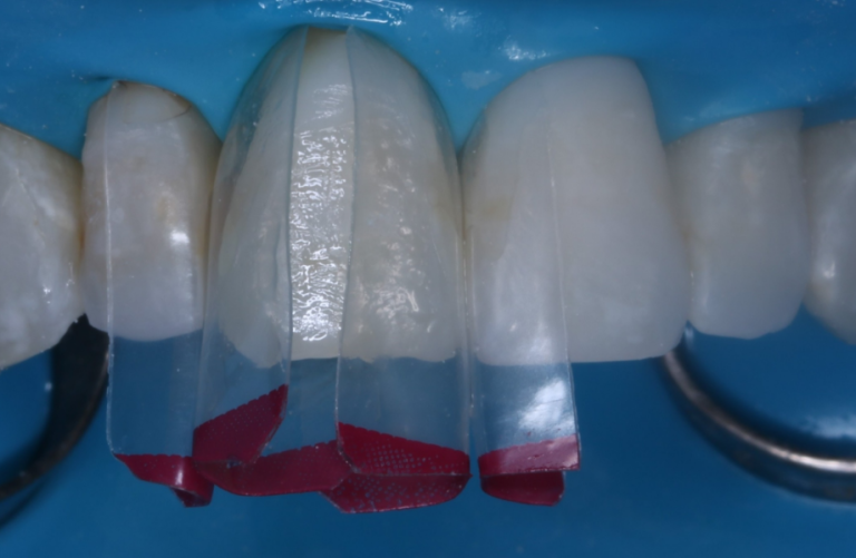 2024-05-18th – Introduction to Injection Moulding and The Bioclear ...